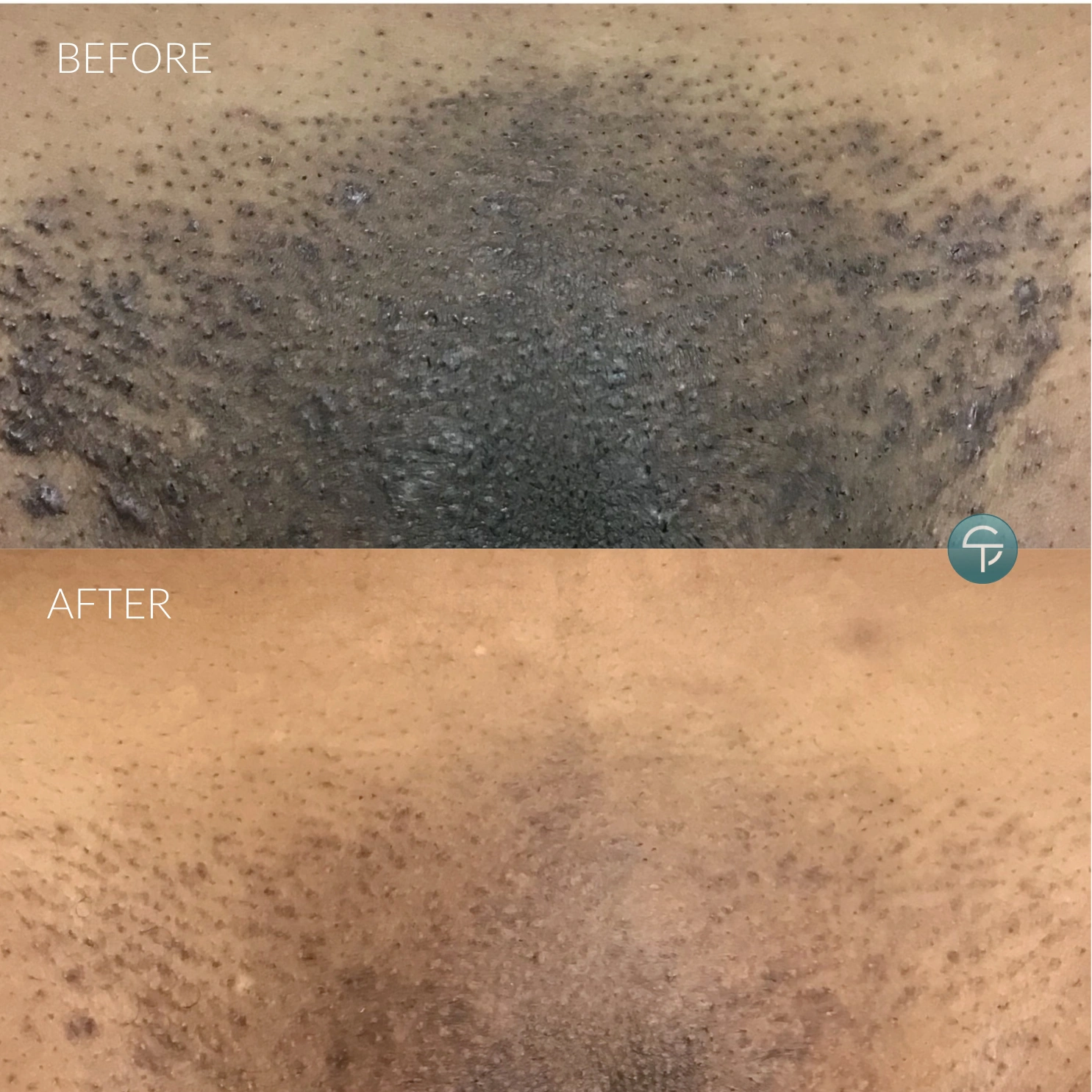 Skintellect Laser & Aesthetics – Advanced Laser Services in Tampa, FL